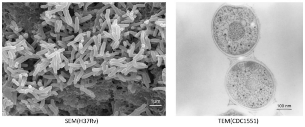 Department of Mycobacterium Reference and Research – [ RIT ] the ...